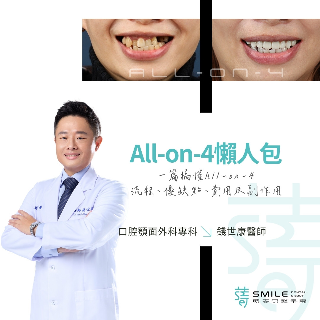[All-on-4懶人包] 一篇搞懂 All-on-4 流程、優缺點、費用及副作用 - 蒔美牙醫集團