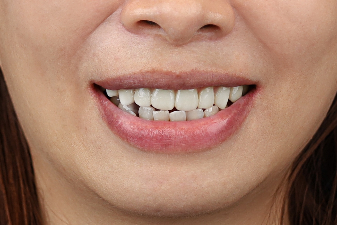 Rayface200 3D臉部掃描機 - 蒔美牙醫集團