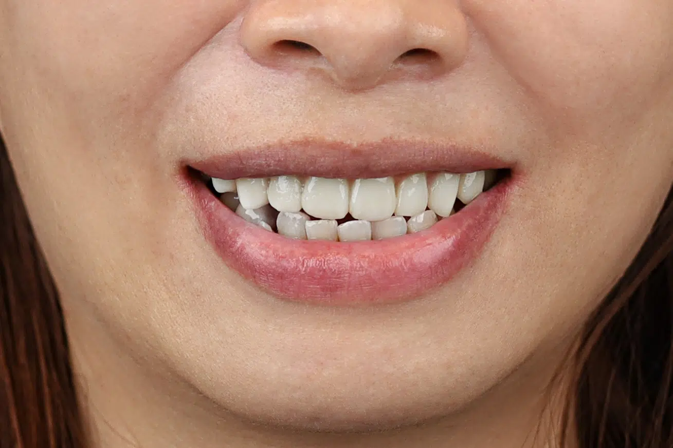 Rayscan 3D 斷層全口側顱環形數位攝影機 - 蒔美牙醫集團